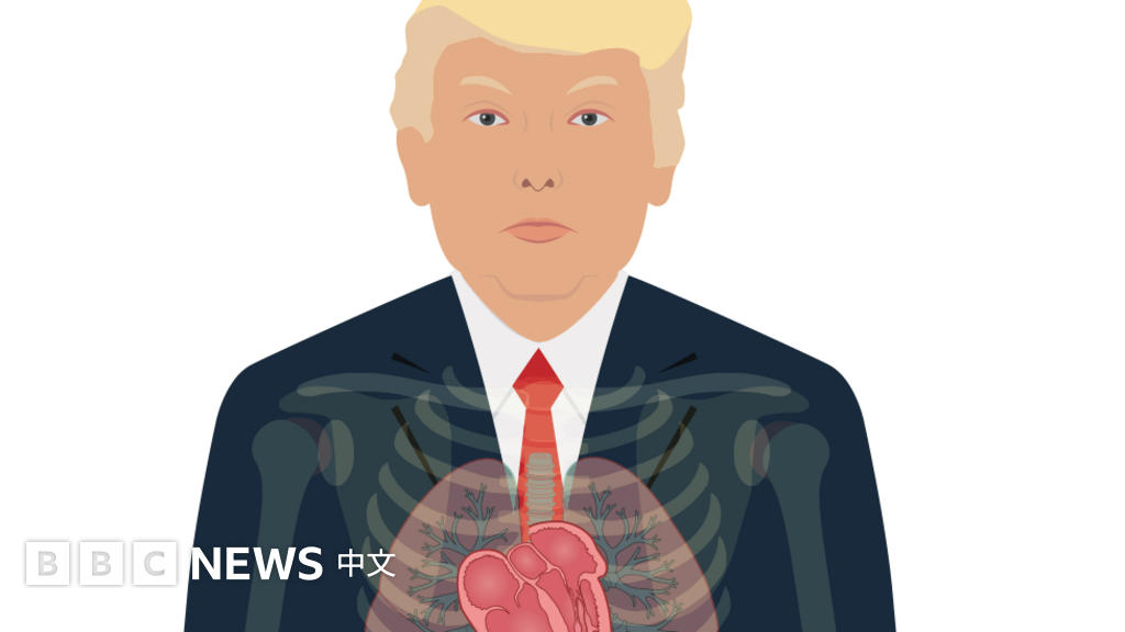 特朗普看医生：总统的身体检查会透露甚么？ - BBC News 中文