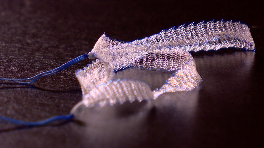 Minister says expert will look at mesh implants review - BBC News