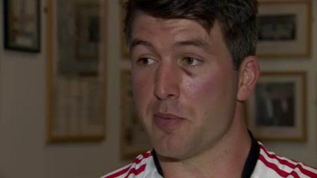 Ulster SFC Final: Peter Turley says Down criticism was justified - BBC ...