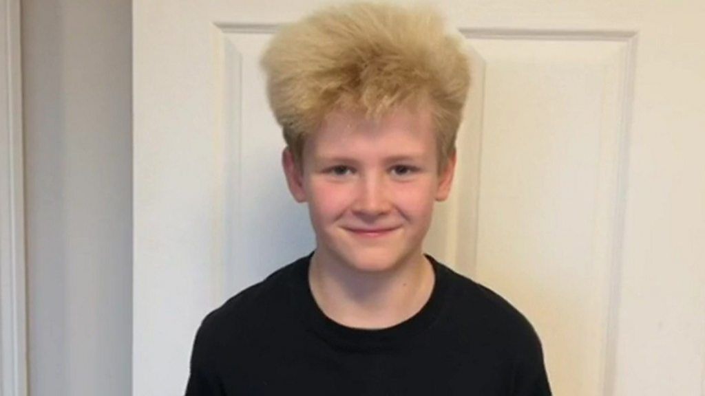 Uncombable hair syndrome: Sam tells his story - BBC Newsround