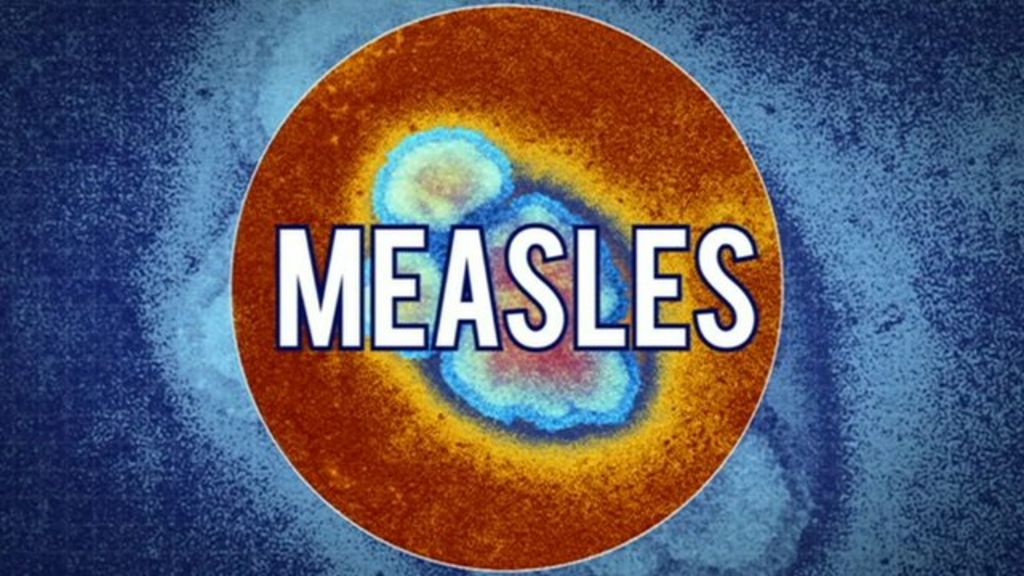 Measles jabs in Welsh schools after Swansea outbreak - BBC Newsround