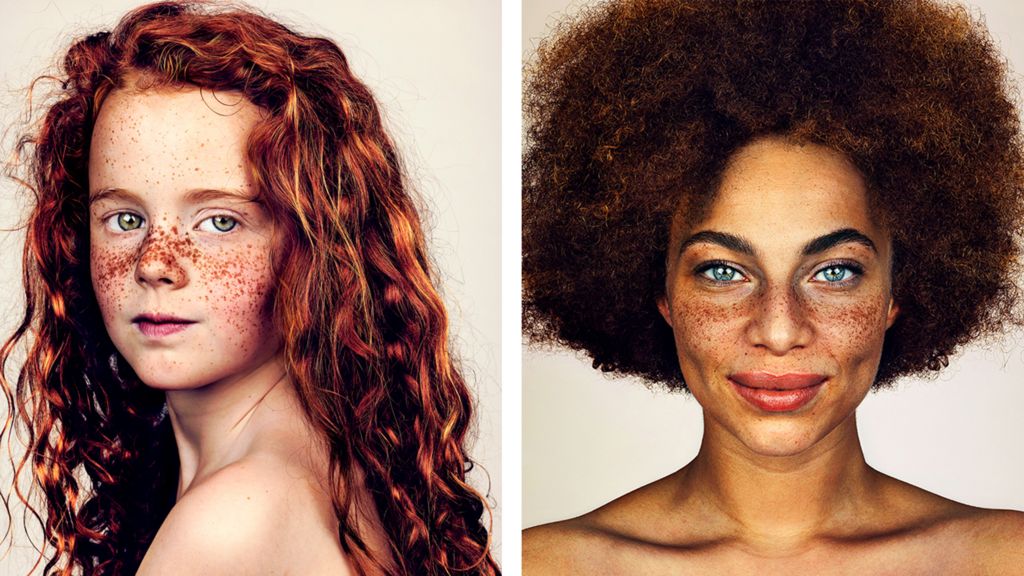 These photos will make you love your freckles - BBC Three