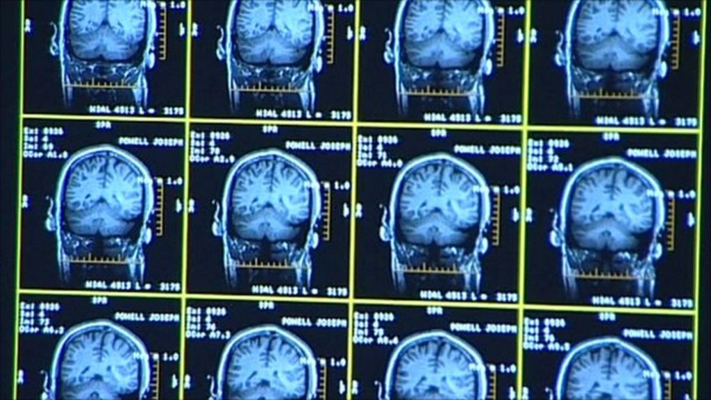 New brain scan detects autism in 15 minutes - BBC News