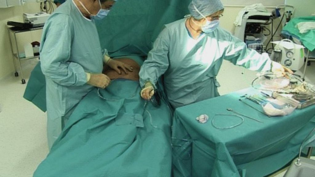 How to perform laser-assisted liposuction - BBC News