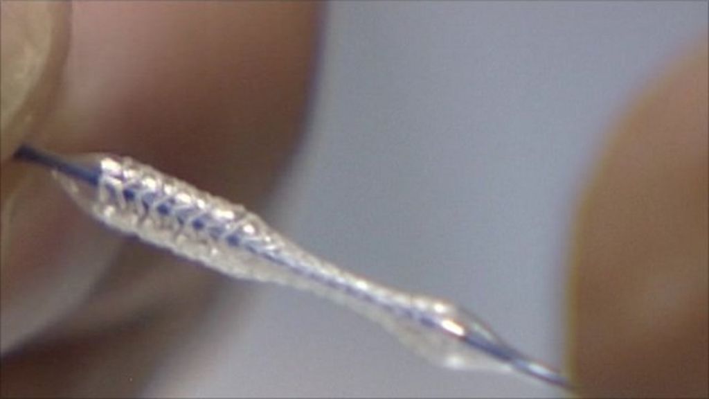 Dissolving heart stent trialled - BBC News
