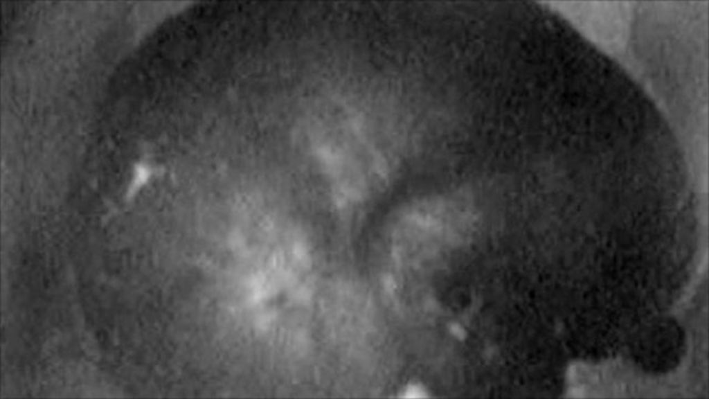 Black bear hibernating filmed in infrared - BBC News