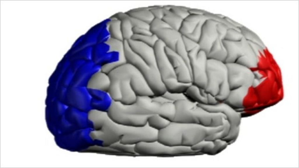 Research suggests autistic brains 'work differently' - BBC News