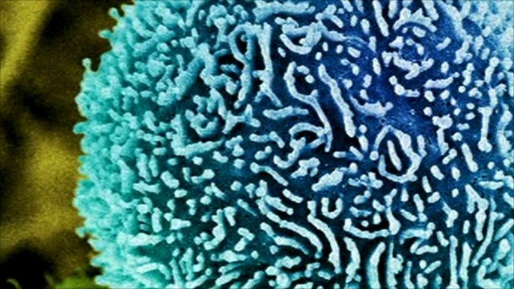 Hope for pancreatic cancer 'vaccine as treatment' trial - BBC News