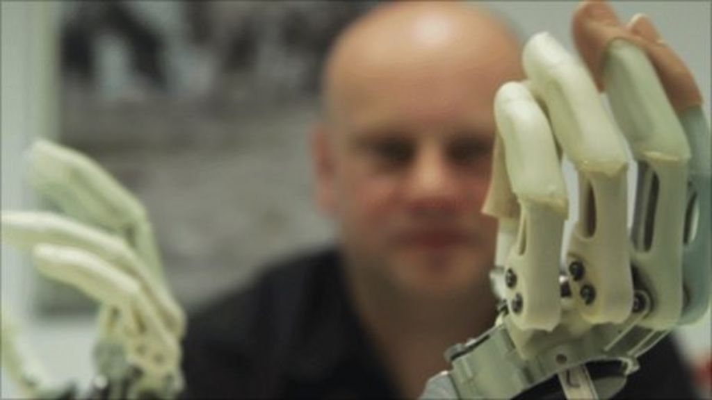 New bionic wrists that turn and hands that feel - BBC News
