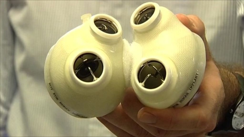 How does an artificial heart work? - BBC News