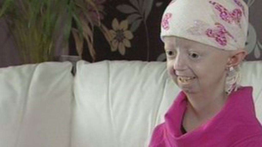 Progeria may be treated by drug, researchers say - BBC News