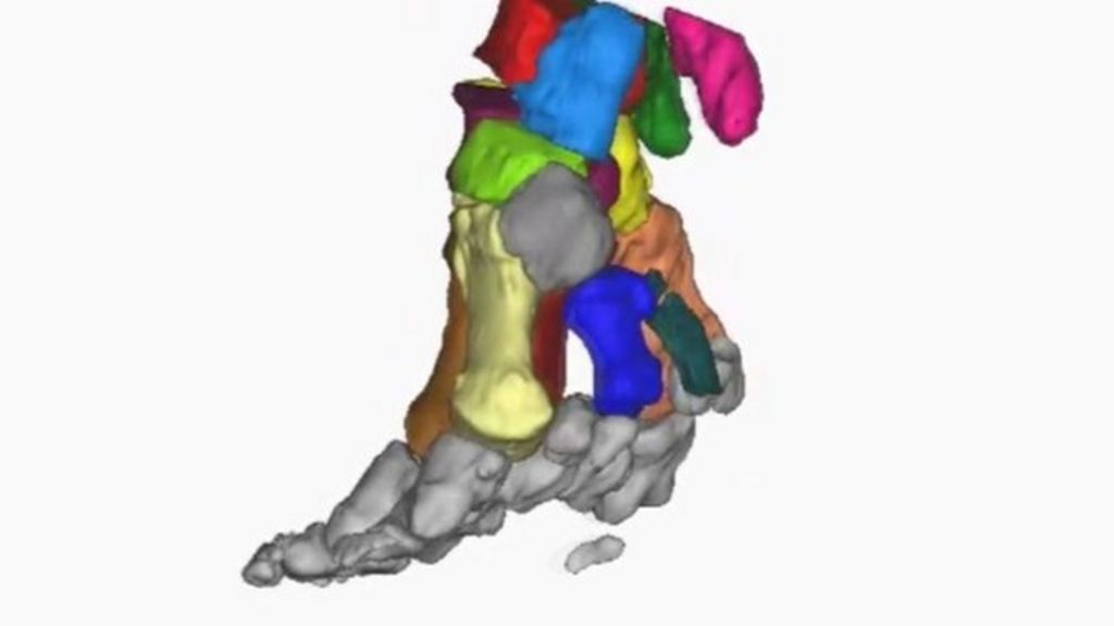 Elephant's sixth 'toe' discovered - BBC News