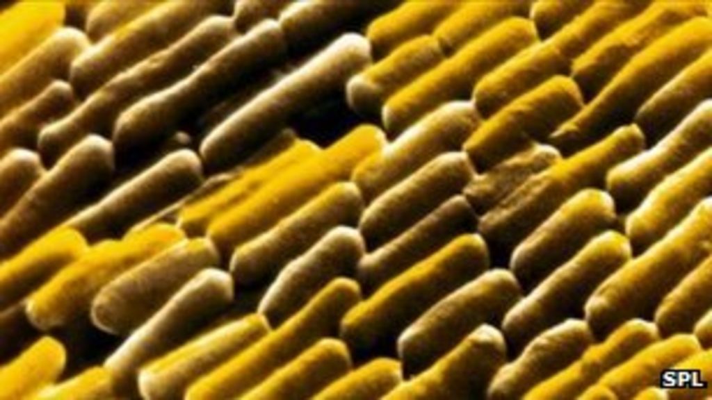 Scottish anthrax outbreak 'worst in UK in 50 years' - BBC News