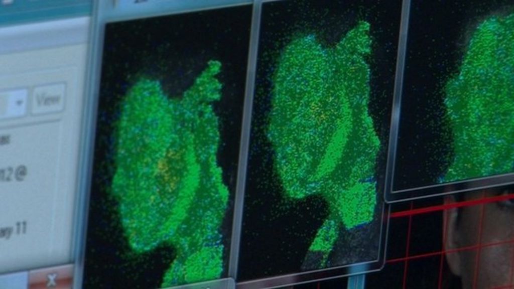 3D face scan to help future surgery - BBC News