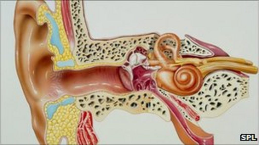 Ear implant restores woman's hearing - BBC News