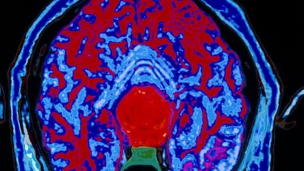 A woman with learning difficulties 'retrains her brain' - BBC News