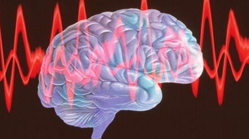 EEG brain trace 'can detect autism' - BBC News