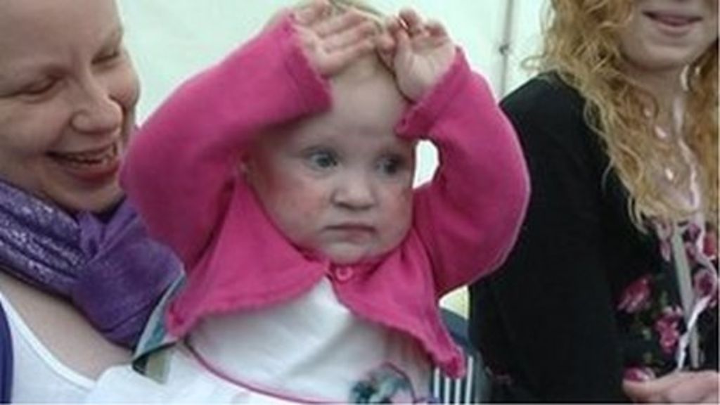 First party for transplant baby - BBC News