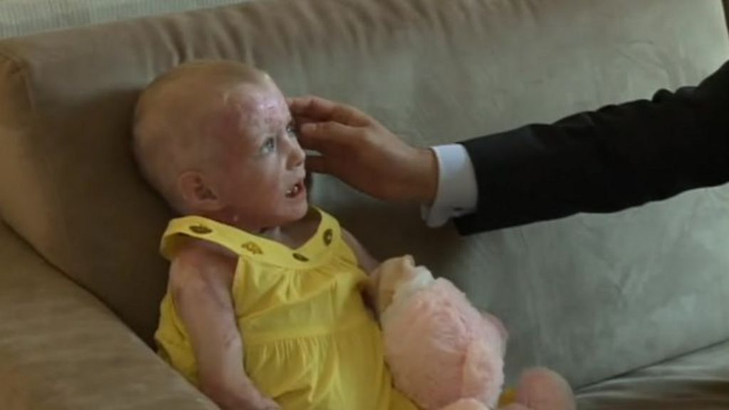 'Amazing' Pippie beats the odds to return home - BBC News