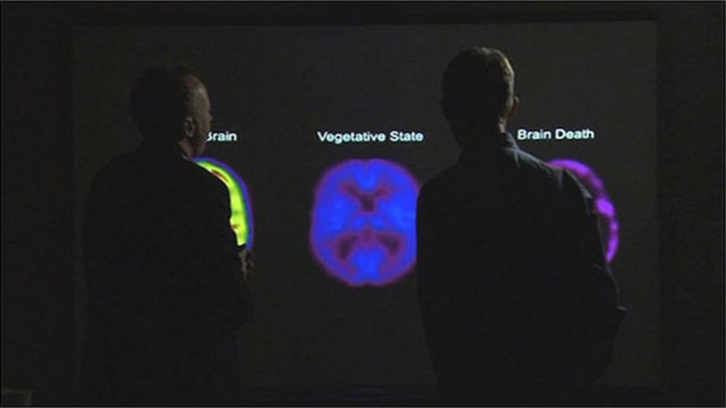 What does a vegetative state mean for the brain? - BBC News