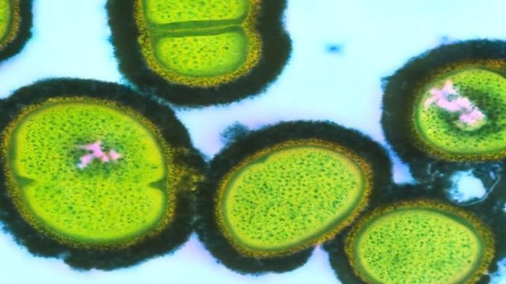 Cambridge DNA research stops MRSA outbreak - BBC News