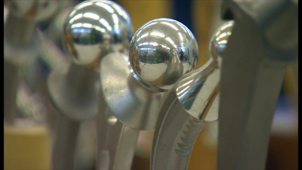 Charnley's hip replacement technique turns 50 - BBC News