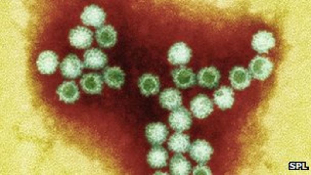 Norovirus vomiting bug hits five north Wales hospitals - BBC News