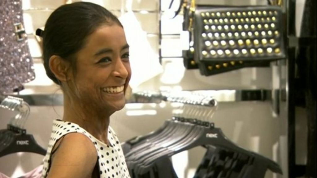 Burns victim models for UK clothes retailer Next - BBC News
