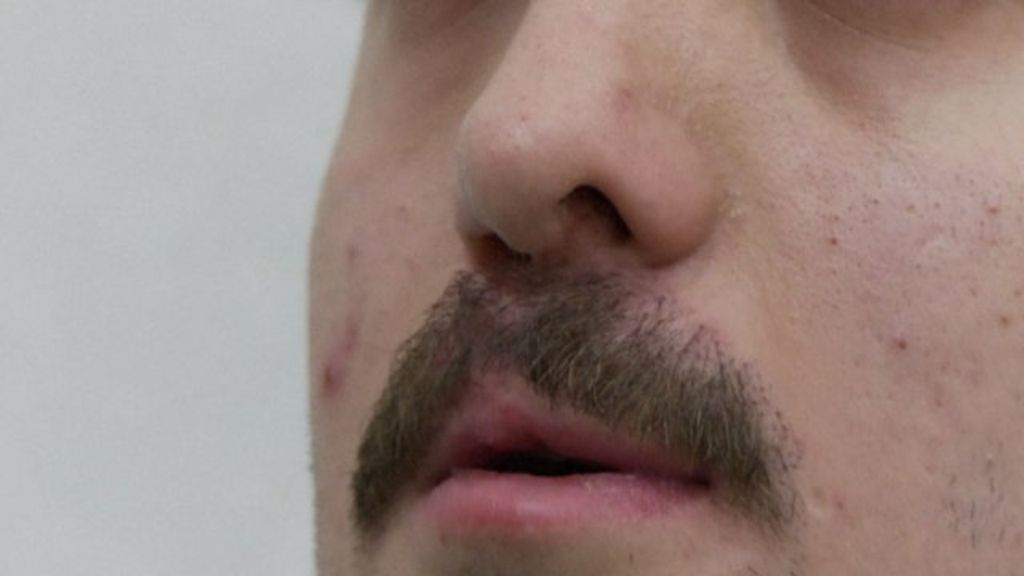 Turkish clinics offer moustache implants - BBC News