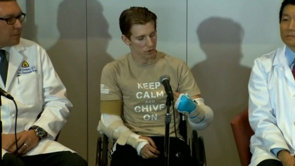 Soldier receives double arm transplant - BBC News