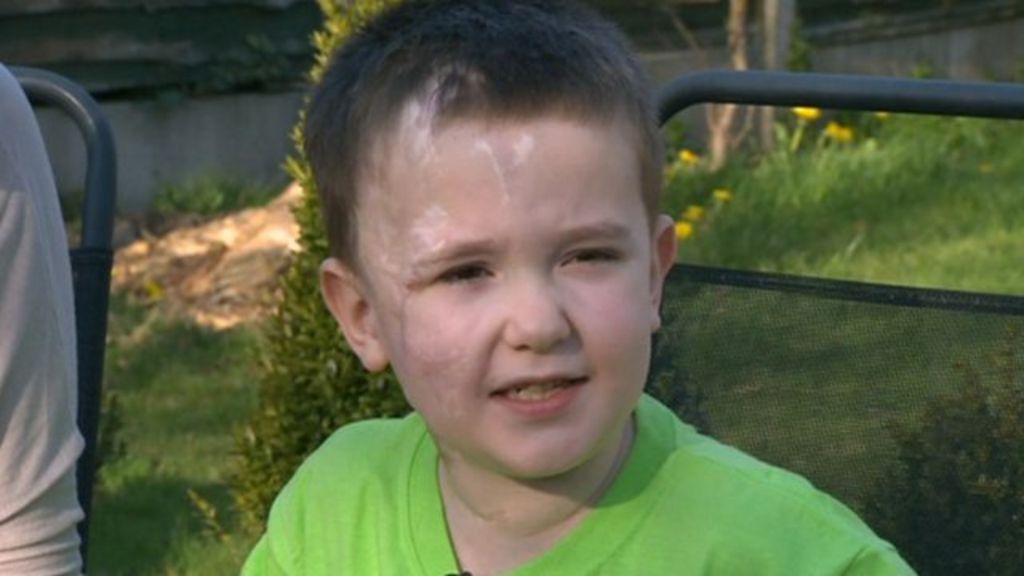 Meningitis amputee, 7, joins fun run - BBC News