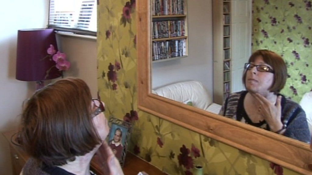 Botox used to help treat burns victim - BBC News