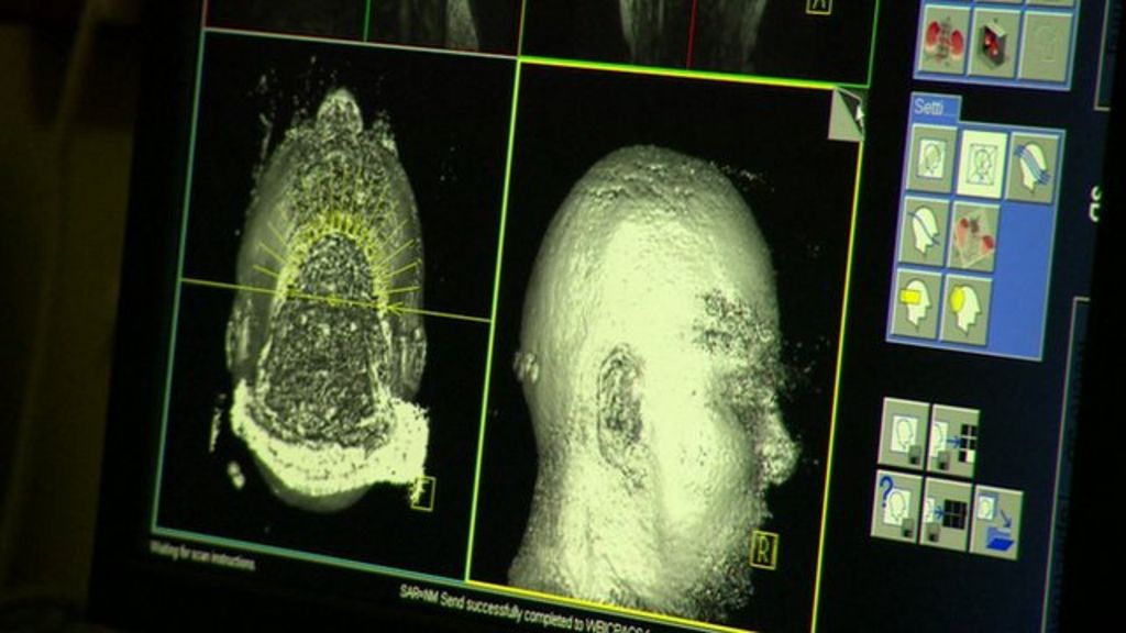 Brain scan study to understand workings of teenage mind - BBC News