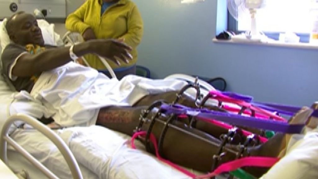 Pedestrian lost arm after uninsured driver accident - BBC News