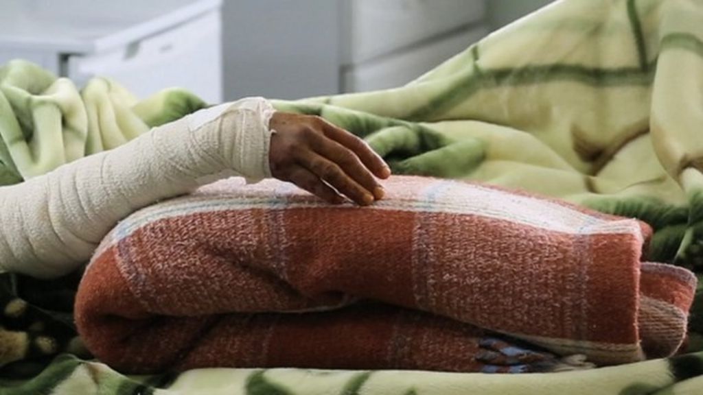 Social injustice 'driving Iraqi Kurdistan women to self-immolate' - BBC ...