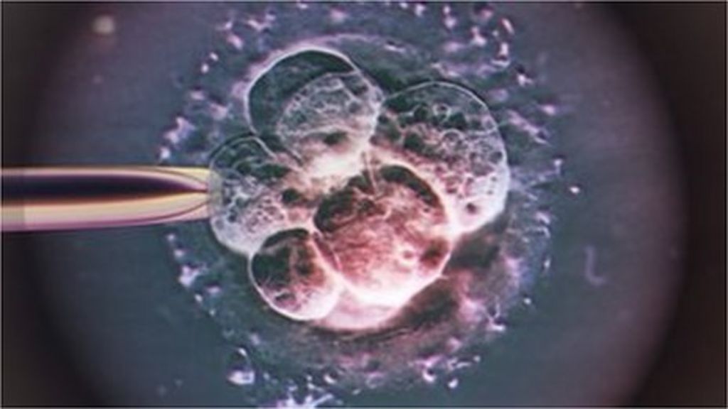 Viewpoints: What does the future of IVF look like? - BBC News