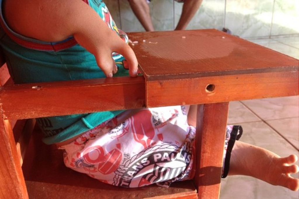 Brazil's new generation of Thalidomide babies - BBC News