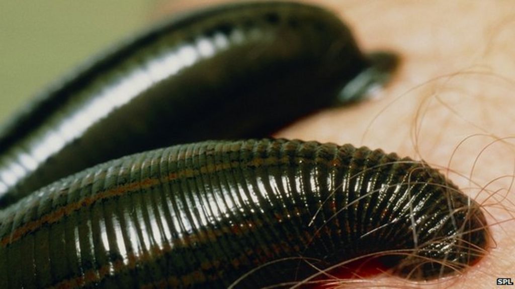 Medicinal leech farming making a comeback in Wales - BBC News