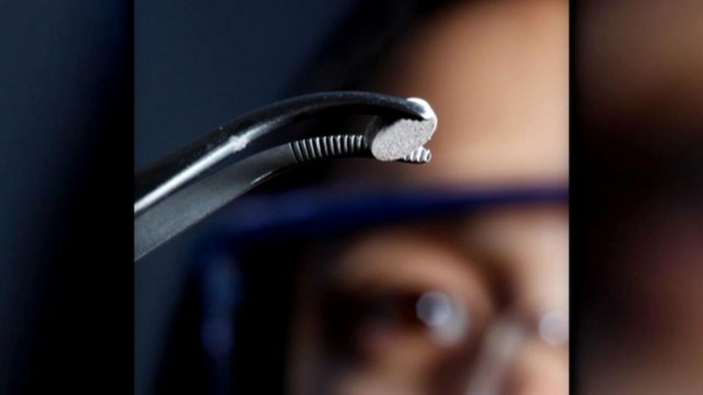 Skin cancer 'vaccine implant' trial begins in America - BBC News