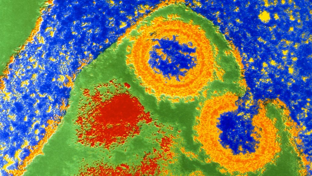 Vaccine 'clears HIV-like virus' in monkeys - BBC News