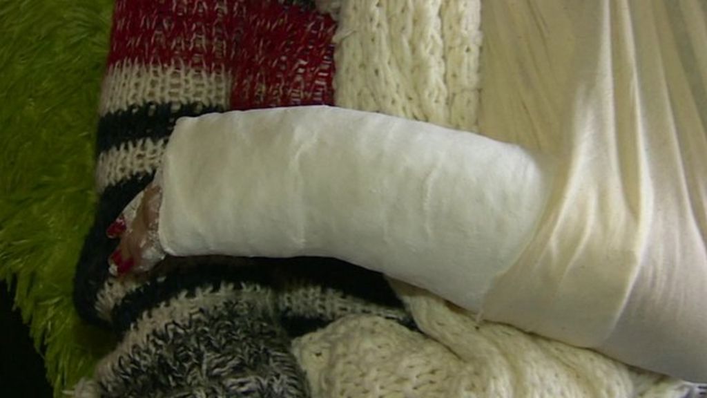 Black Friday: Injuries in UK shopping frenzy - BBC News