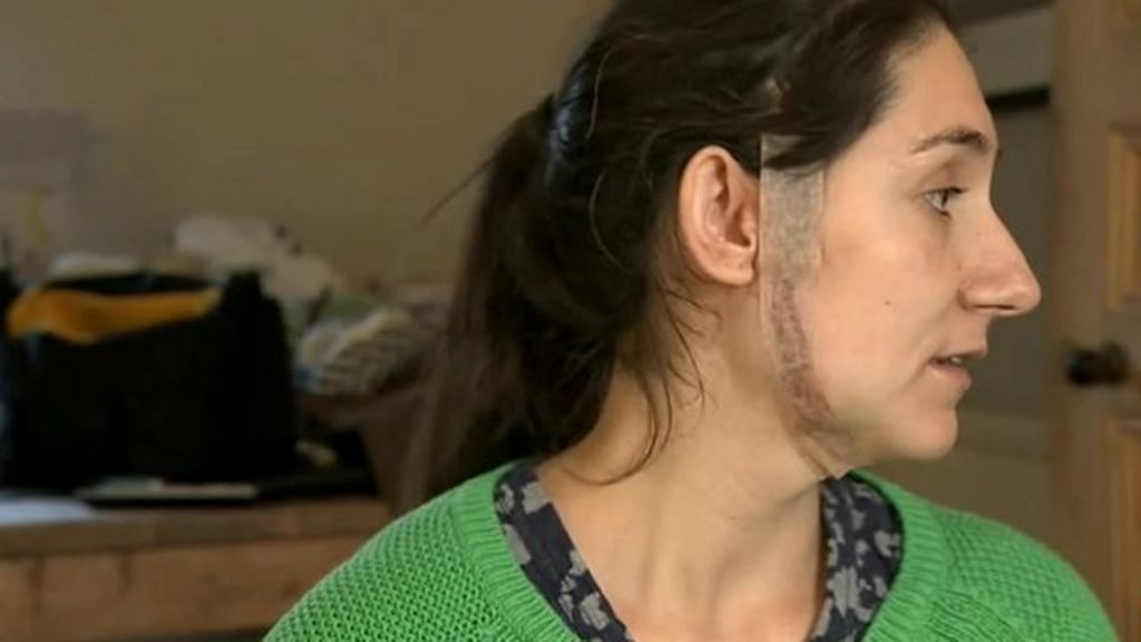 Cambridge woman slashed across face - BBC News