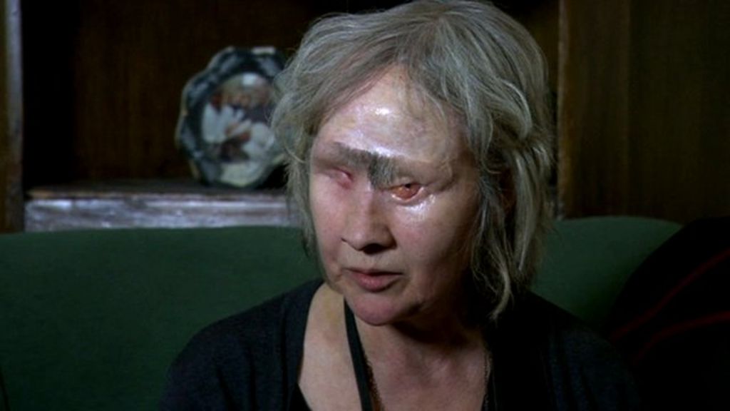 Wendy Hamriding: Dog biting face 'saved my life' - BBC News