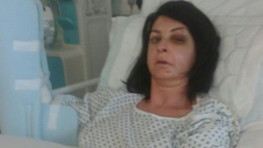 Sleepwalking fall victim 'recovering from injuries' - BBC News