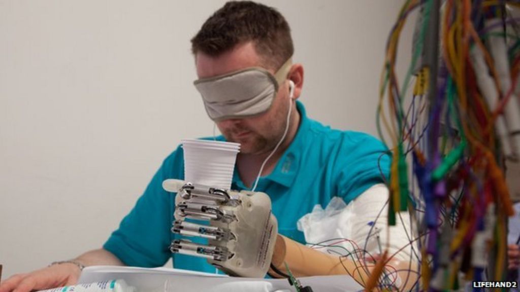 Bionic hand allows patient to 'feel' - BBC News