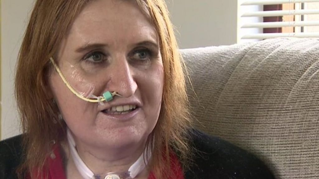 Stag gore victim 'lucky to be alive' - BBC News