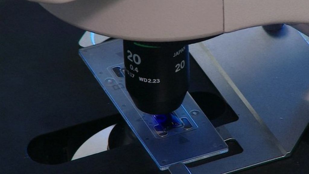 HIV: Gene therapy breakthrough patients on medication - BBC News