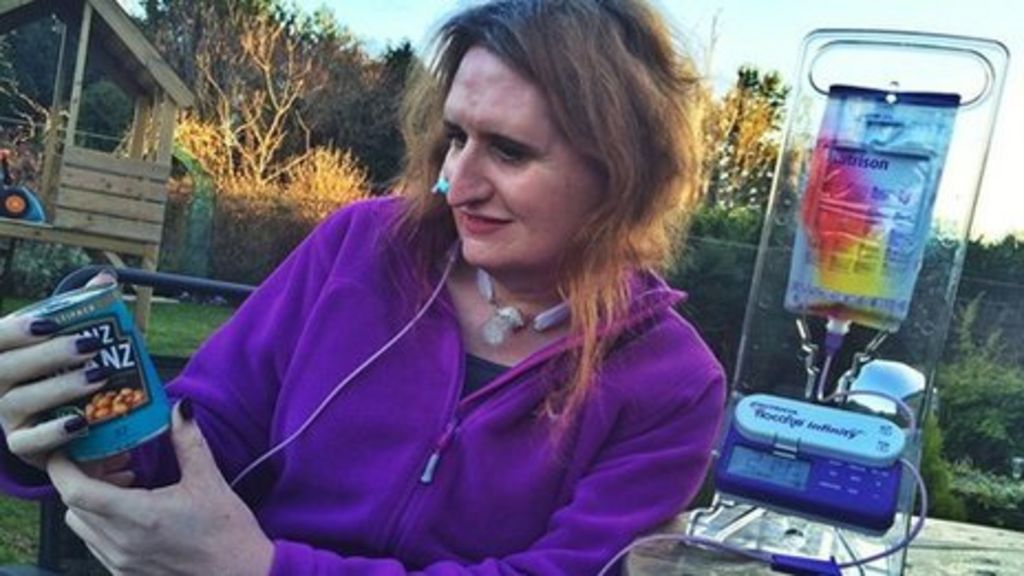 Stag gore victim Dr Kate Stone faces third throat operation - BBC News