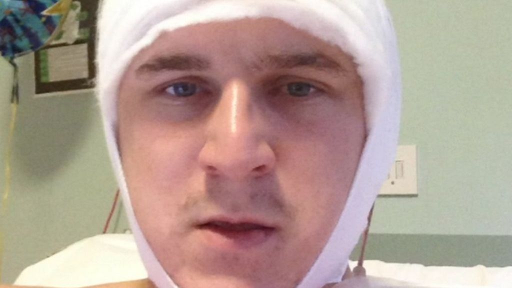 Ear bite attacks 'costing NHS' - BBC News