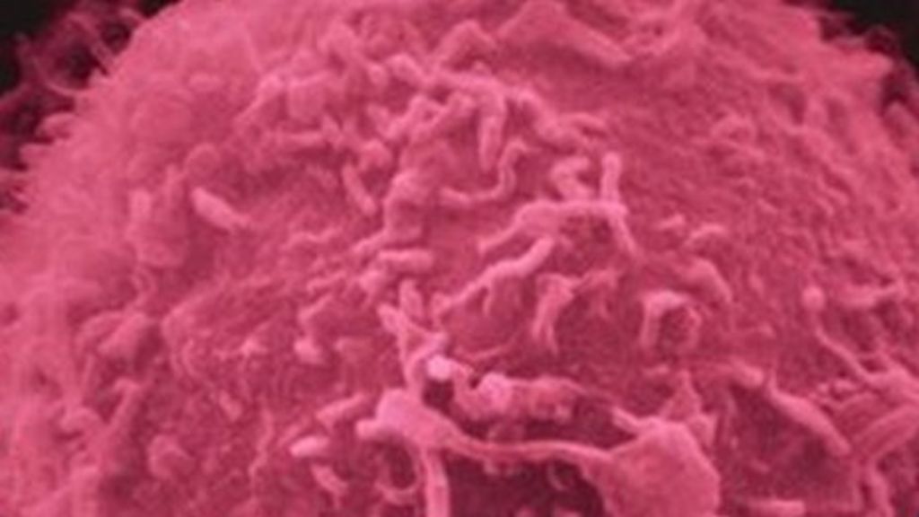 Leukaemia: Cardiff University breakthrough in disease treatment - BBC News